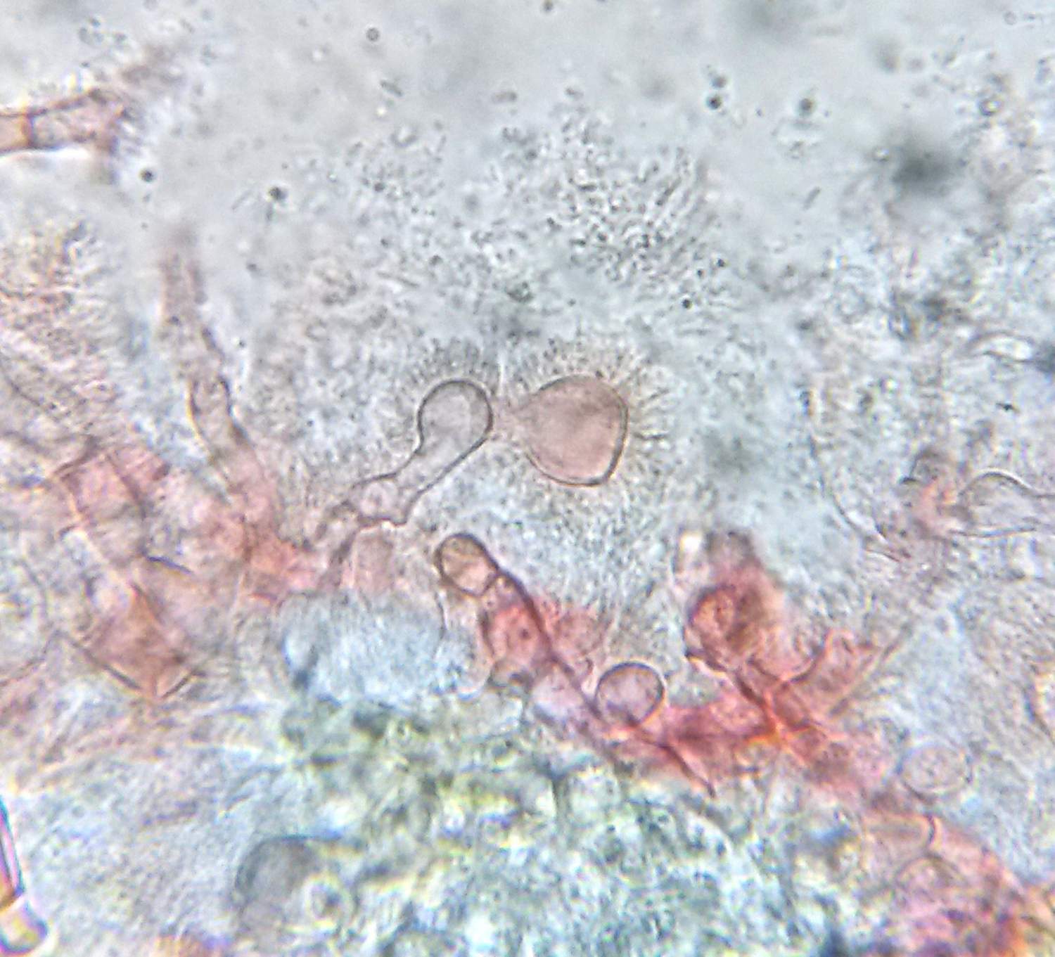 Myco Magic: Microfungi on land plants - Metasphaeria complanata at ...