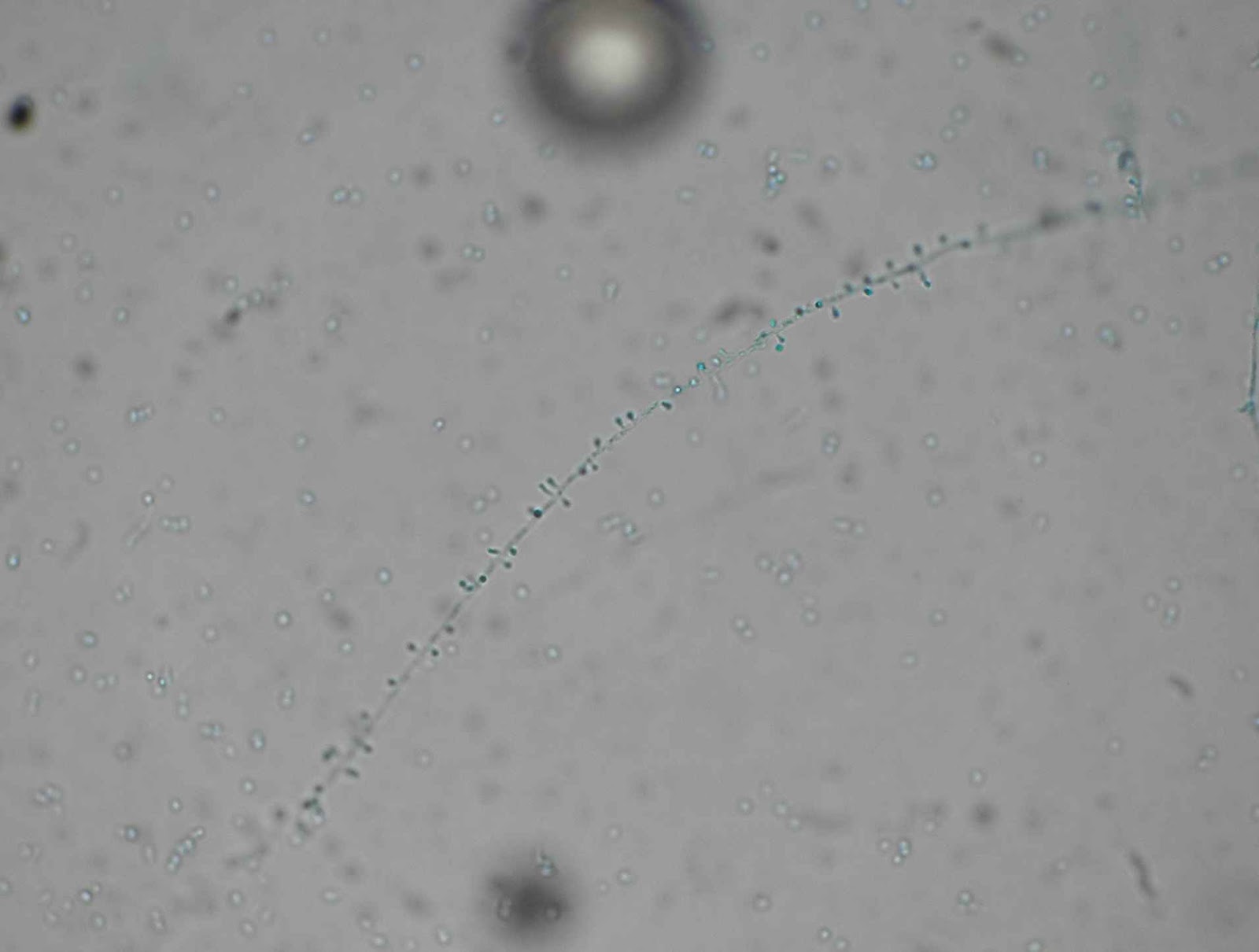 ATLAS MICOLOGIA: TRICHOPHYTON RUBRUM