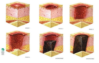 ER goldbook: Pressure injury