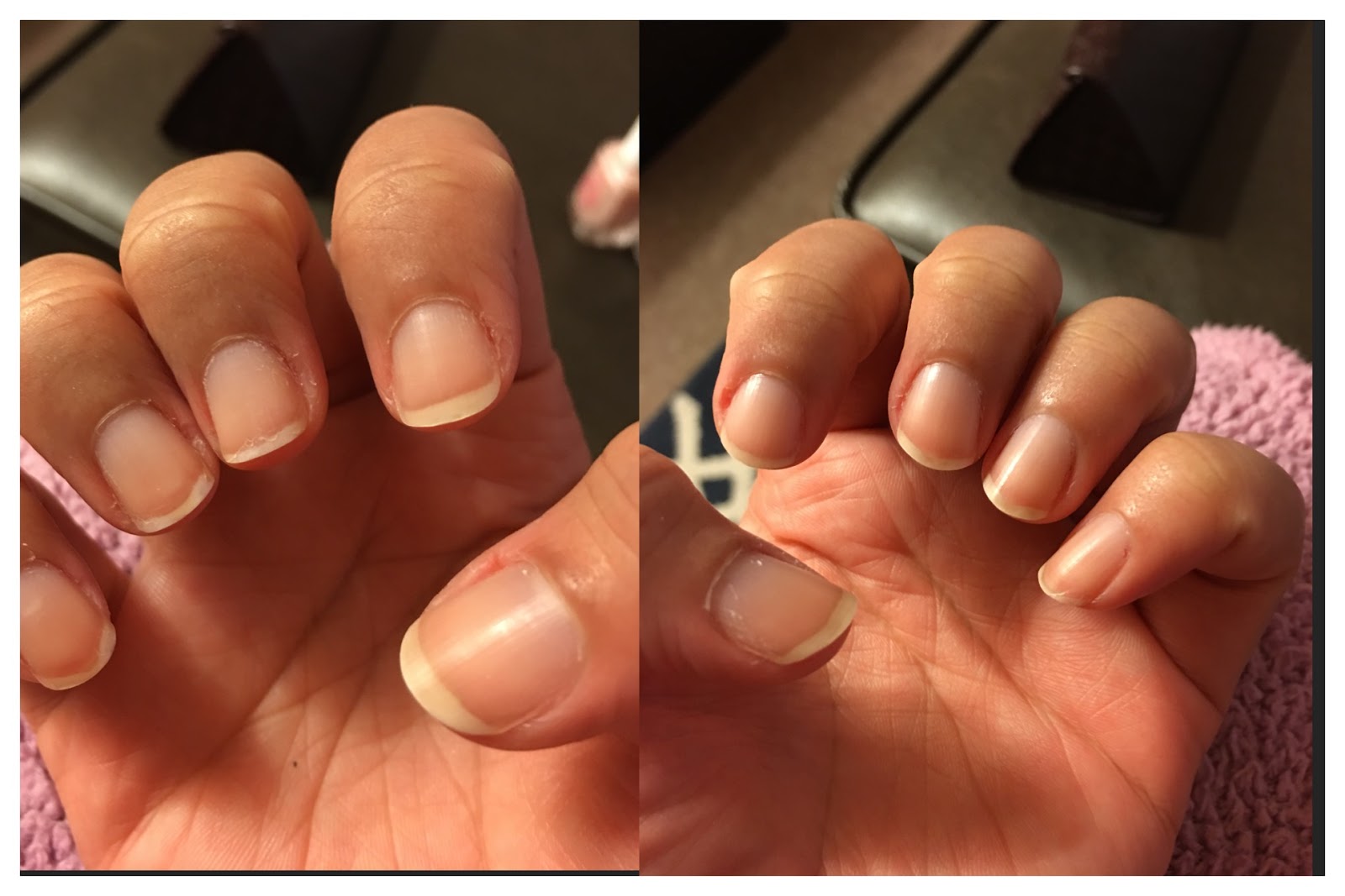 My Nail Growth Journey and the Best Tips and Tricks for Treating Your Nails