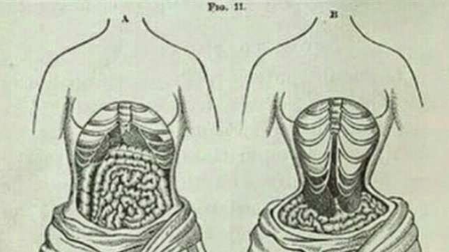 Waist training corset: 5 dangers of waist trainers