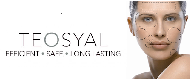 Freshen up your face with Teosyal Dermal Filler! | Beauty Crazed in Canada