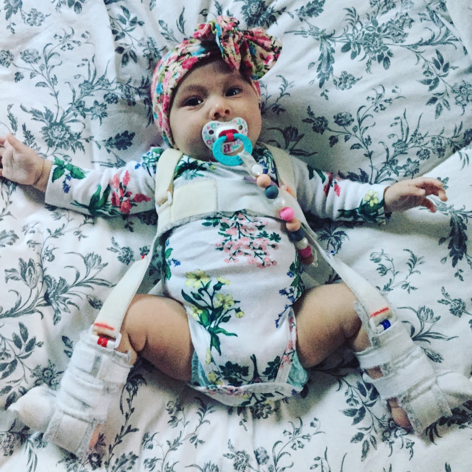 Lily's E'Claires: Camille's Hip Dysplasia ~ Life with a Pavlik Harness