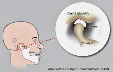 la prothèse dentaire: L’occlusion en prothèse adjointe partie1