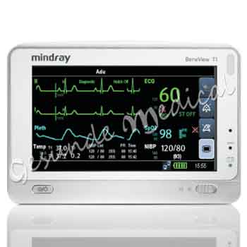 Pasien Monitor Portable Multifungsi | Patient Monitor (Alat Monitor ...