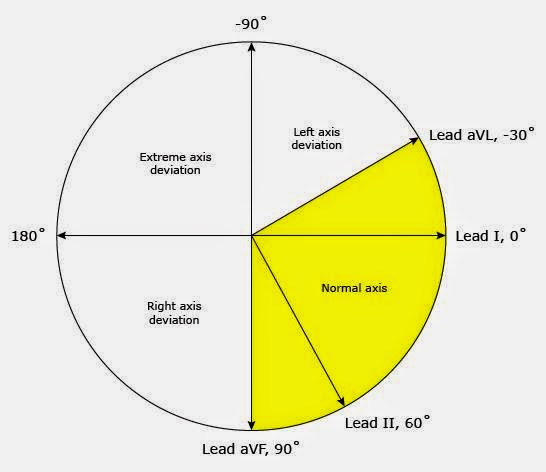 Chest Medicine Made Easy-Dr Deepu: How To determine the Mean Electrical ...
