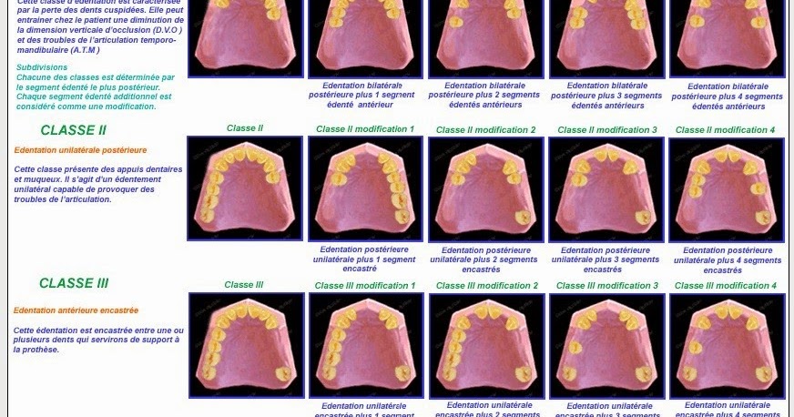 ESTOMATOLOGIA PASO A PASO PARA ESTUDIANTES: PPR: CLASIFICACIÓN DE ...