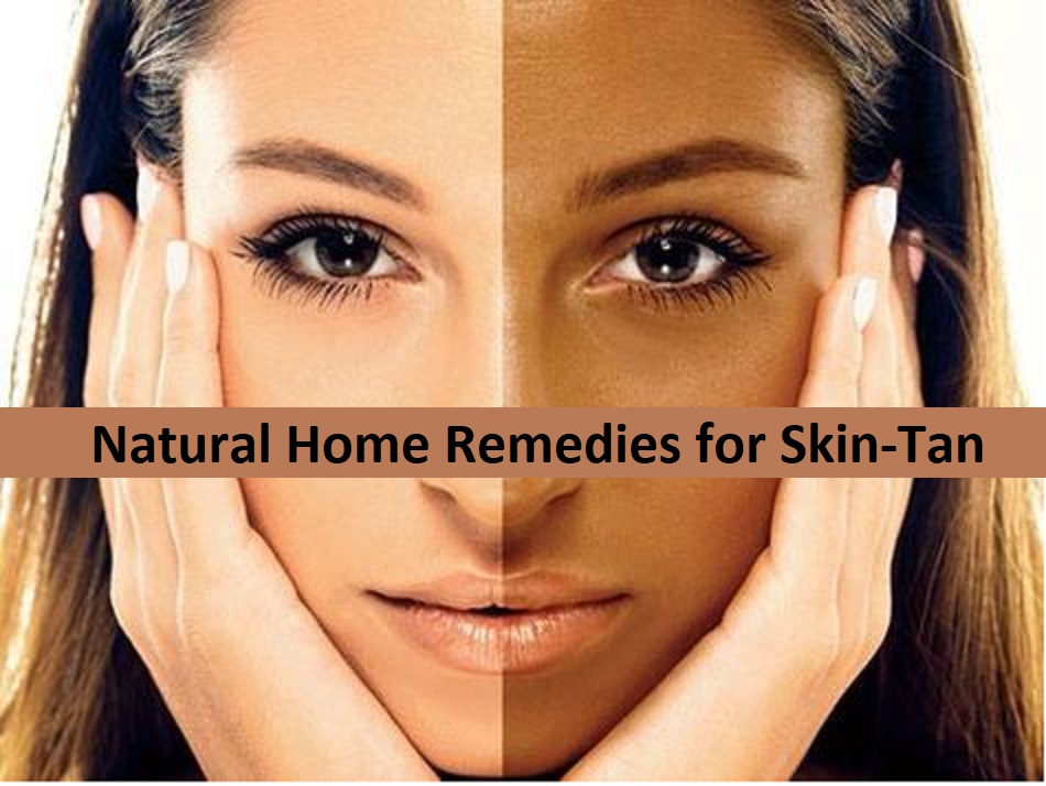 No More Worries about Skin Tan !! Some Natural Remedies are Here