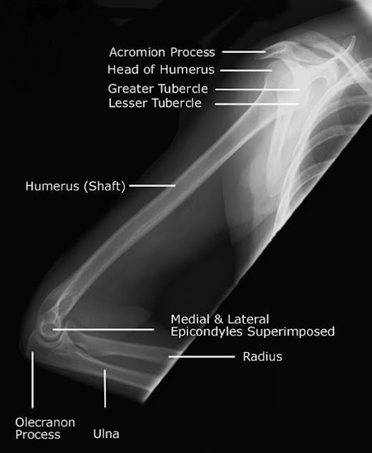 Medical and Health Science: Humerus Lateral!!