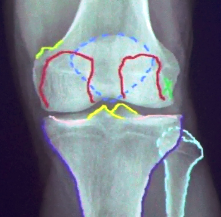 RADIODIAGNOSTICO: NOVENA CLASE DE RADIODIAGNOSTICO