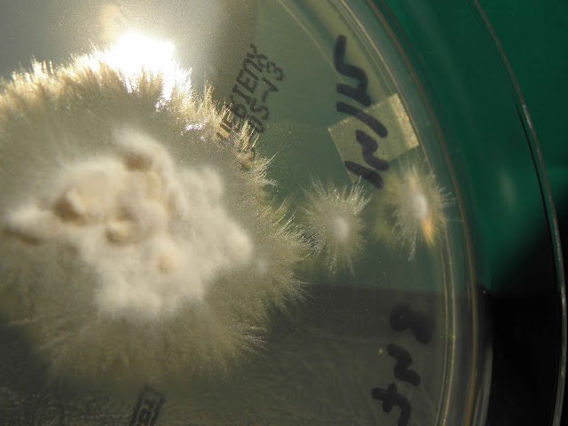 ATLAS MICOLOGIA: MICROSPORUM CANIS (2º CASO CLÍNICO)