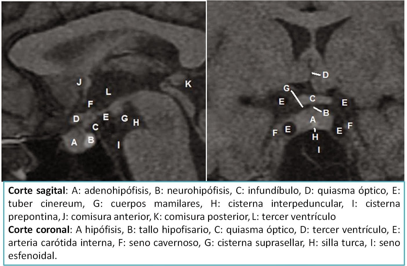 ESPE 203-2013: Patología de región selar: rol de imagenología