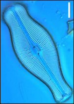 The Dish on Fish: Tenacious Trespasser #1: Didymo