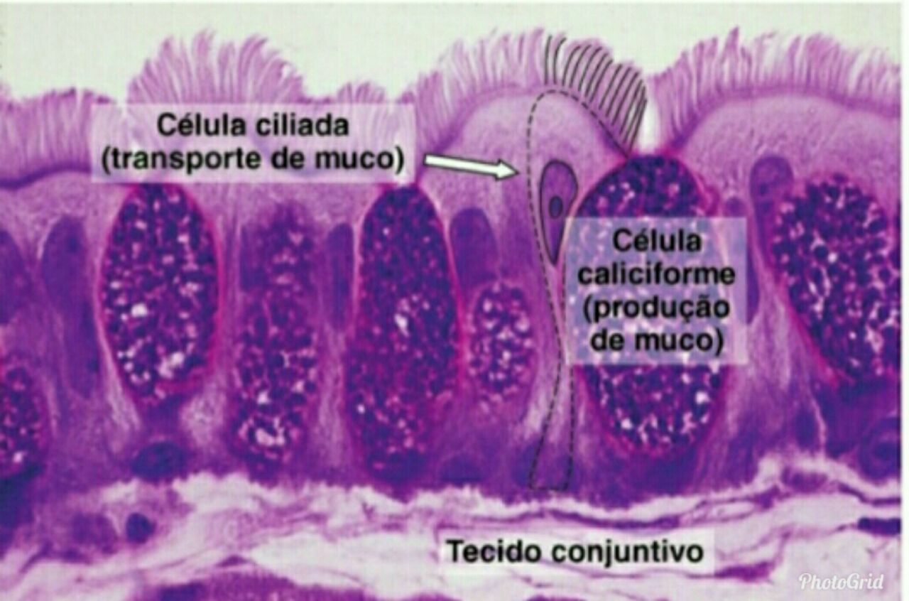 Saúde e a química da célula humana: CÉLULAS CALICIFORMES E DOENÇAS ...
