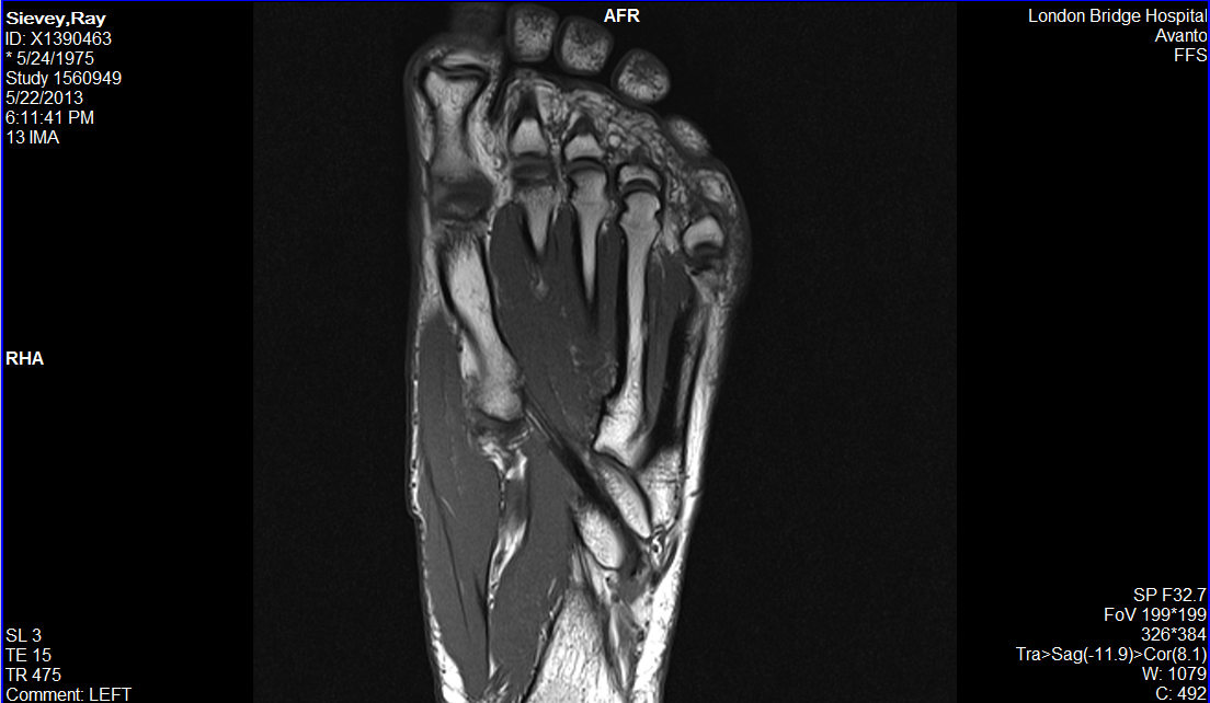 The Jogging Hippo's Jog Blog: What does MRI stand for?