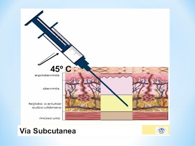 ADMINISTRACIÓN DE MEDICACIÓN: Vía subcutánea