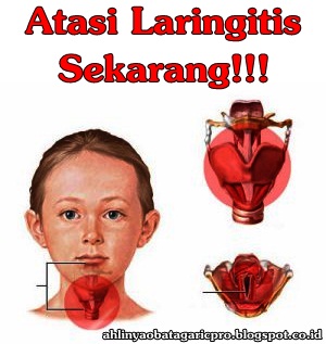 Obat Laringitis Herbal Paling Mujarab ~ Ahlinya Obat AgaricPro