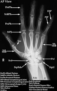 Radiographic positioning: Hand PA