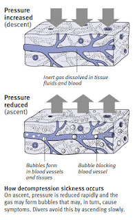 Decompression sickness ~ Nursing