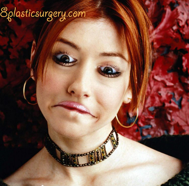 Alyson Hannigan ~ 100 plastic surgery