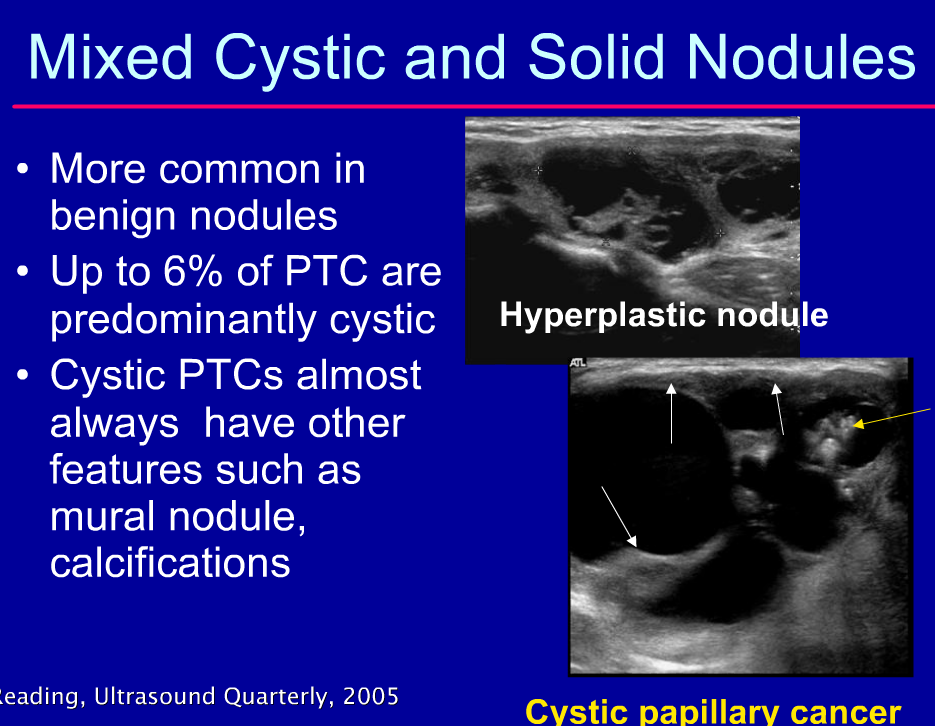 rsna: thyroid and parathyroid US