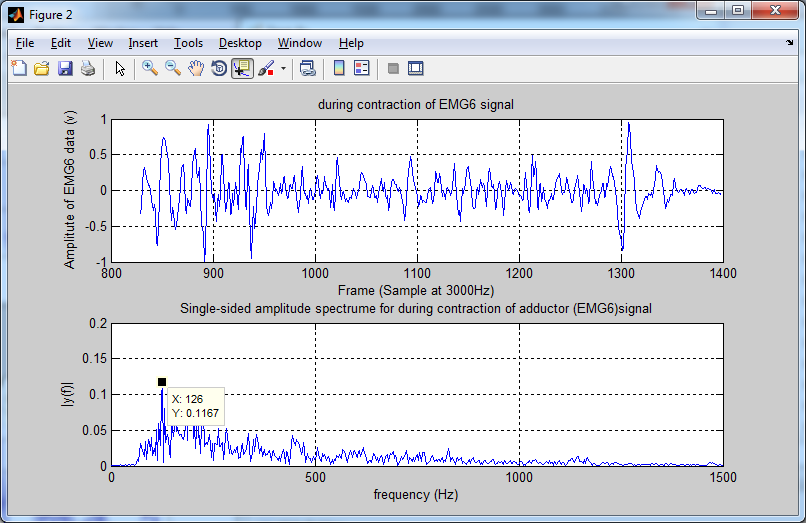 Biomedical Signal And Image Processing Projects Using Matlab And Labview Tools Matlab Code To