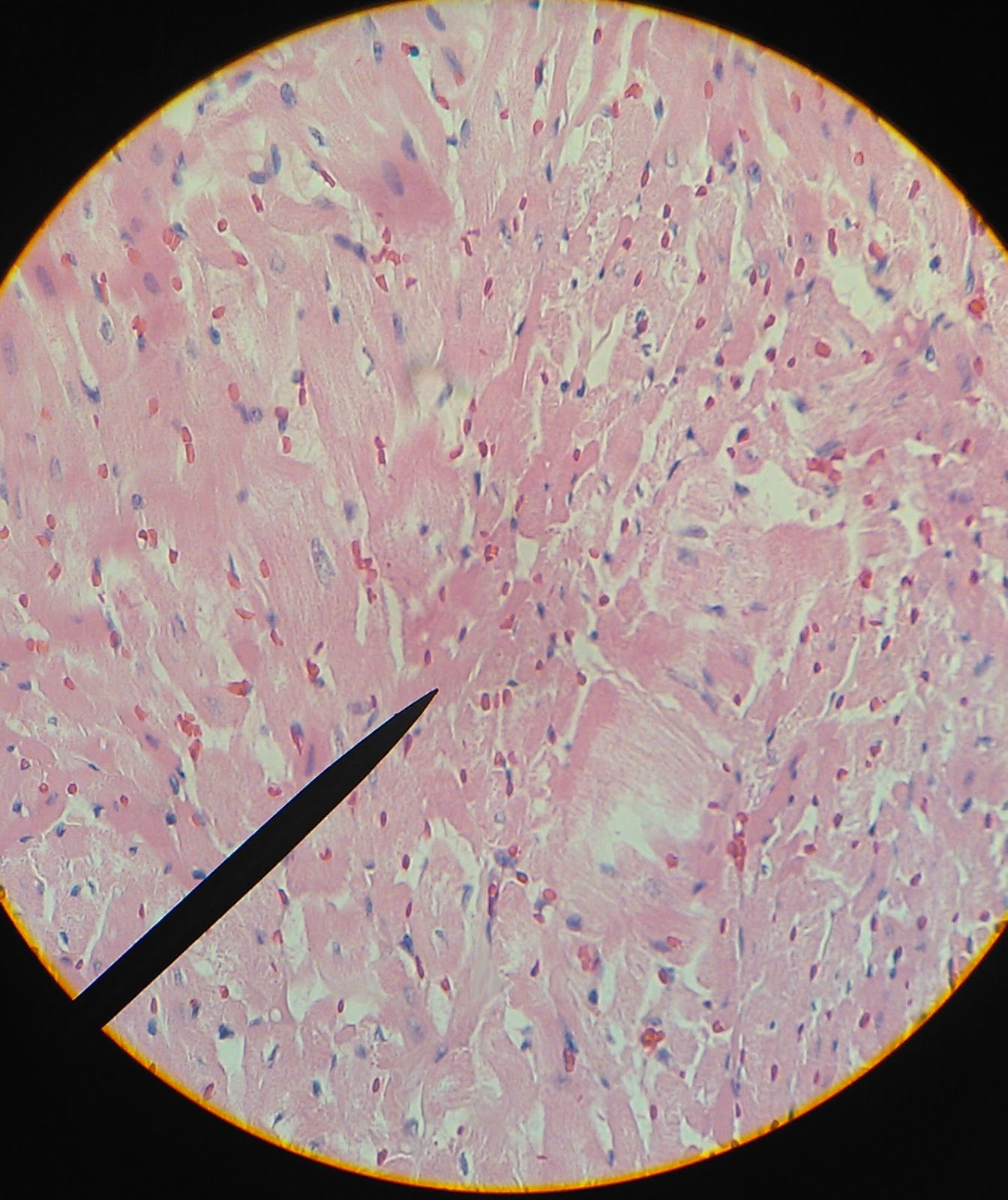 HISTOLOGIA: TEJIDO MUSCULAR