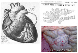 Allah Name on Human Body ~ Islamic Miracles