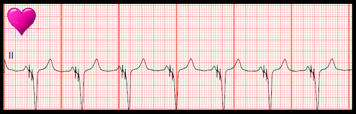 Practice EKG Strips 437