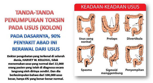 Cara Cuci Usus Paling Berkesan.!!