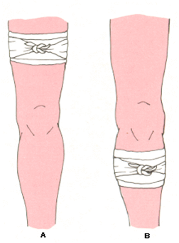 Tecnico en Enfermeria IPP Concepcion: VENDAJES
