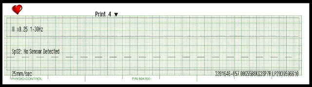 ACLS review: asystole part 1