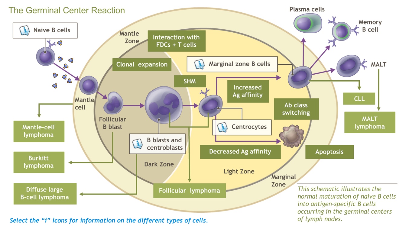 Non-Hodgkin limfom- simptomi, uzroci, lečenje