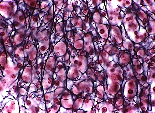 SOS BIOLOGIA CELULAR Y TISULAR: TEJIDO CONECTIVO. FIBRAS 1. Connective ...