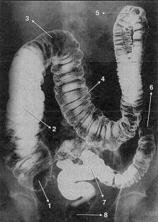 Flanco Esquerdo : 2016