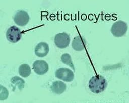 Réticulocytes | Bio Tech Lib