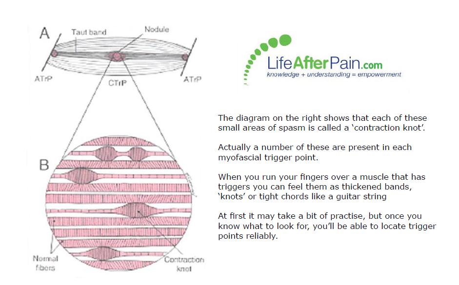 Jennifer Cluff: Musician's Injuries and Self-Trigger Point Therapy