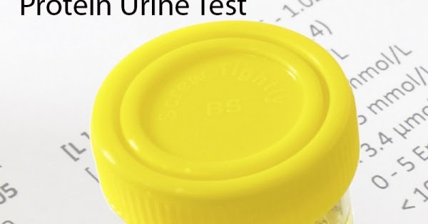 SFN NETWORKS: PEMERIKSAAN PROTEIN URIN METODE BANG