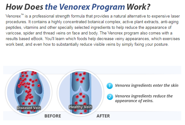 REMOVE HAIR WITHOUT EXPENSIVE SURGERY - BEAUTY SOLUTION