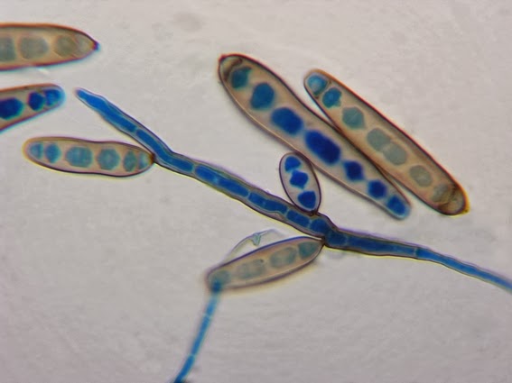 Fun With Microbiology (What's Buggin' You?): Exserohilum rostratum