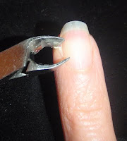 How to Handle a Hangnail