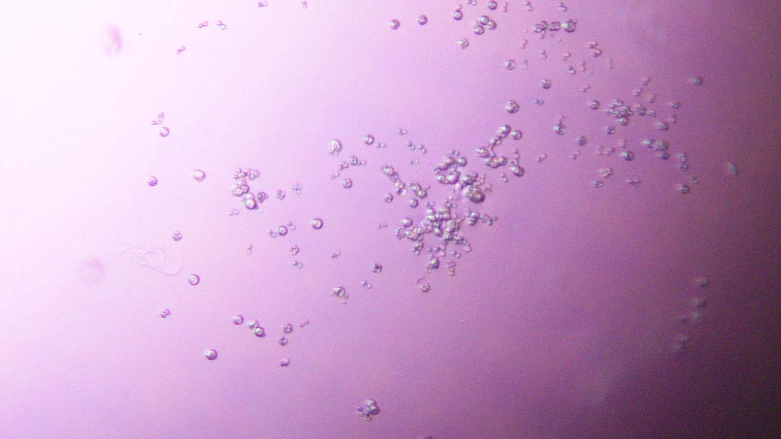 Factor Xa directed Anticlotting serpin like protein (Antithrombin) : MIDAS screen for FXAC MBP ...