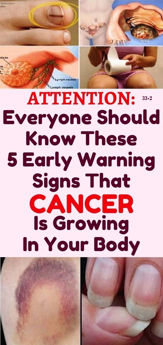 1: Unexplained Weight Loss