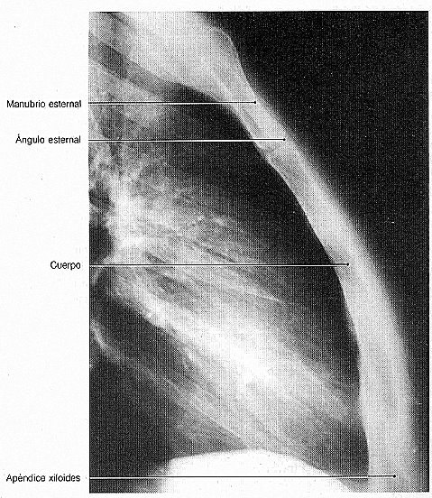 Tecnicas Radiológicas 2011: Esternón Proyección Lateral Posición D o I ...