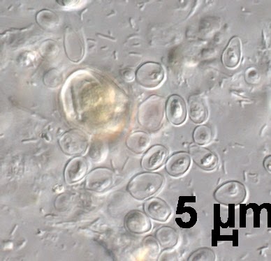 Bee Bugs: "Mystery Spores" in Bee Macerates