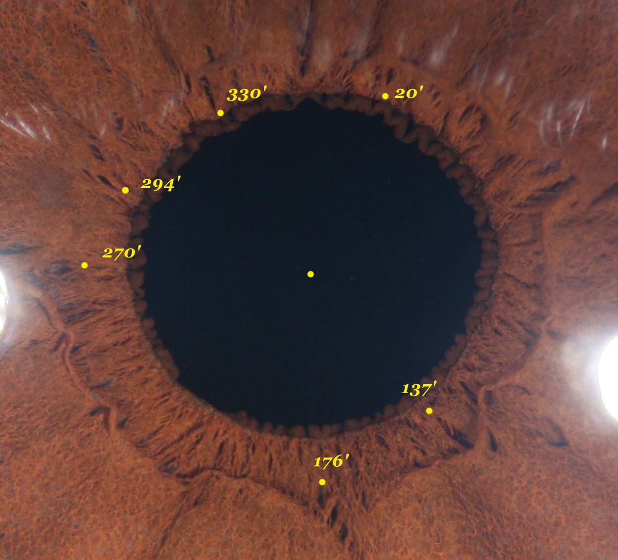 Modern & Multidimensional Iridology: The Pupil, IPB, Pupillary Zone ...