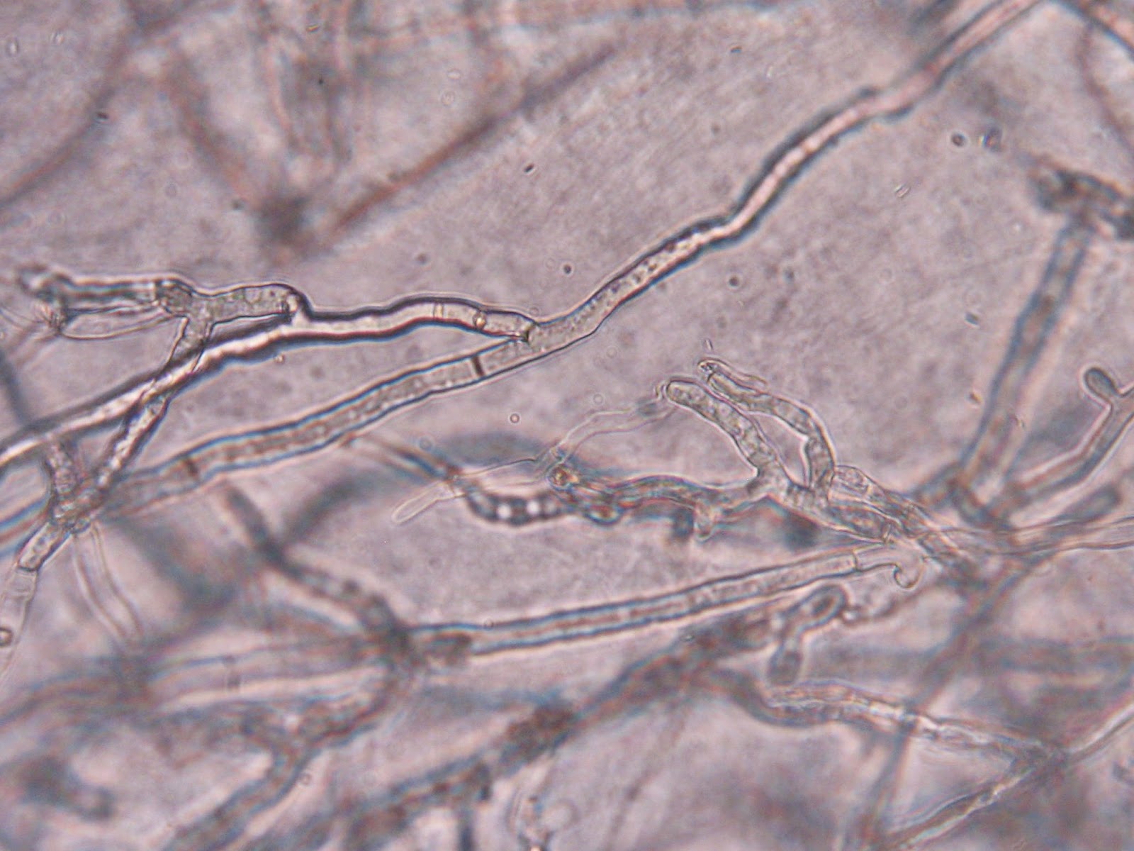 [DIAGRAM] Diagram Of Hyphae - MYDIAGRAM.ONLINE