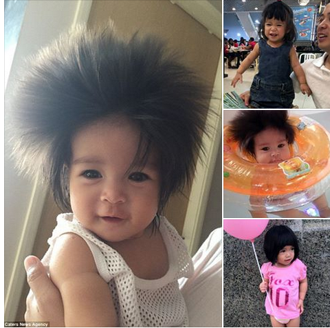 So Cute! Meet the "World's Hairiest Baby" Who Has Become A Viral Sensation