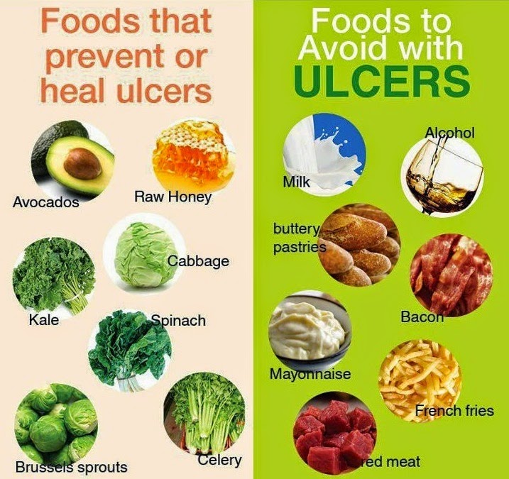 GodBless Health Center: Vidonda vya Tumbo (PEPTIC ULCERS)