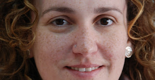 miriamnm-miriam: ¿Cómo quitar las pecas de la cara?